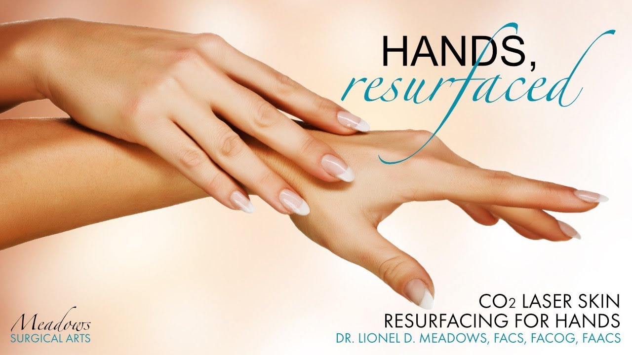 CO2 Laser Skin Resurfacing of Hands | Meadows Surgical Arts - YouTube