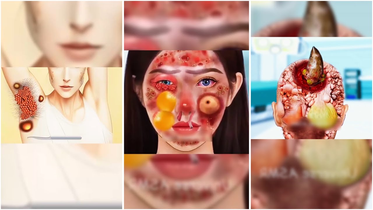 ASMR Worm Ep 583 - YouTube