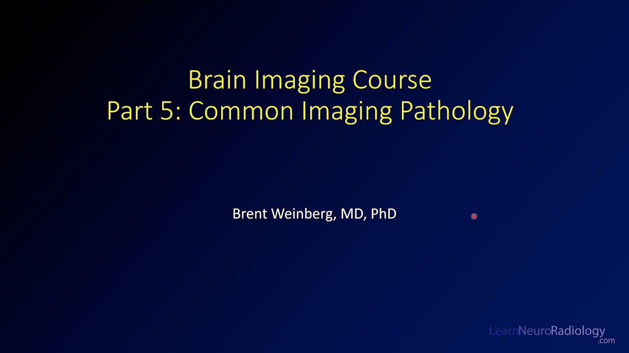 Brain imaging course – 5 – Common imaging pathology - YouTube