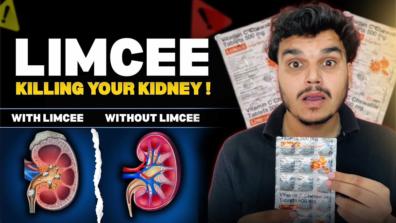 WARNING Limcee Tablet Side Effects You Need to Know - YouTube