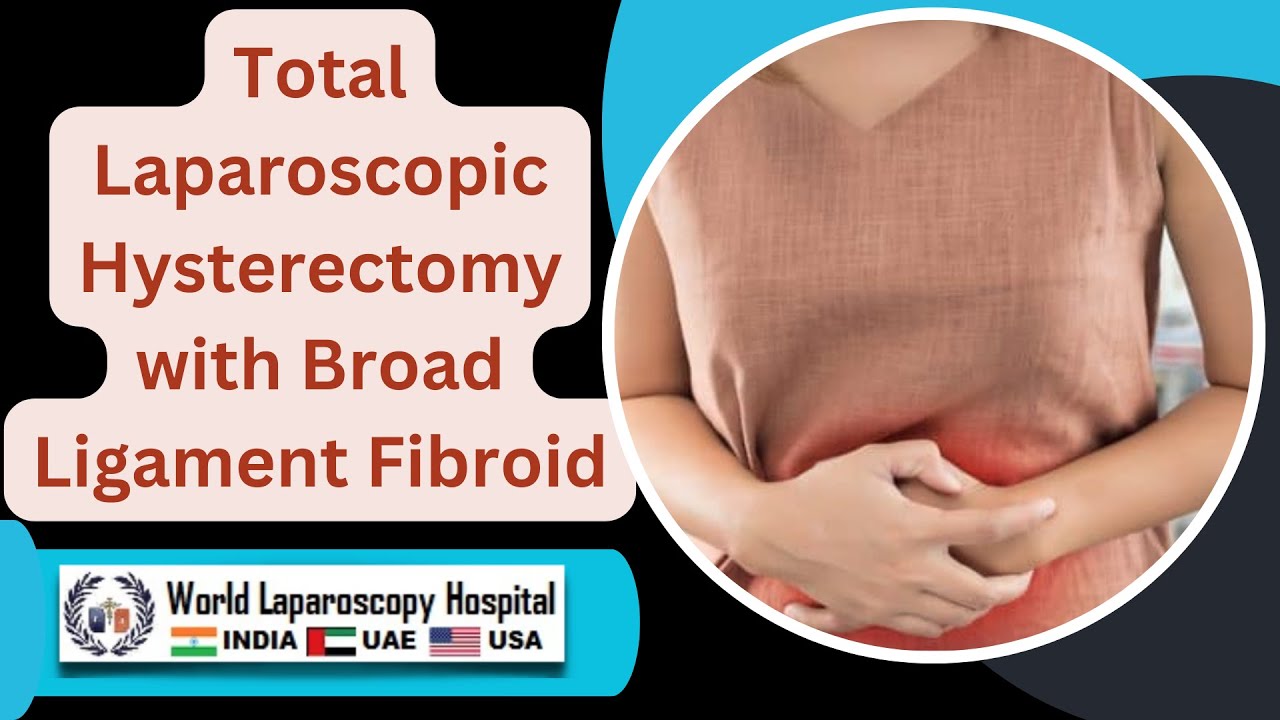 Total Laparoscopic Hysterectomy for a Patient with Broad Ligament ...