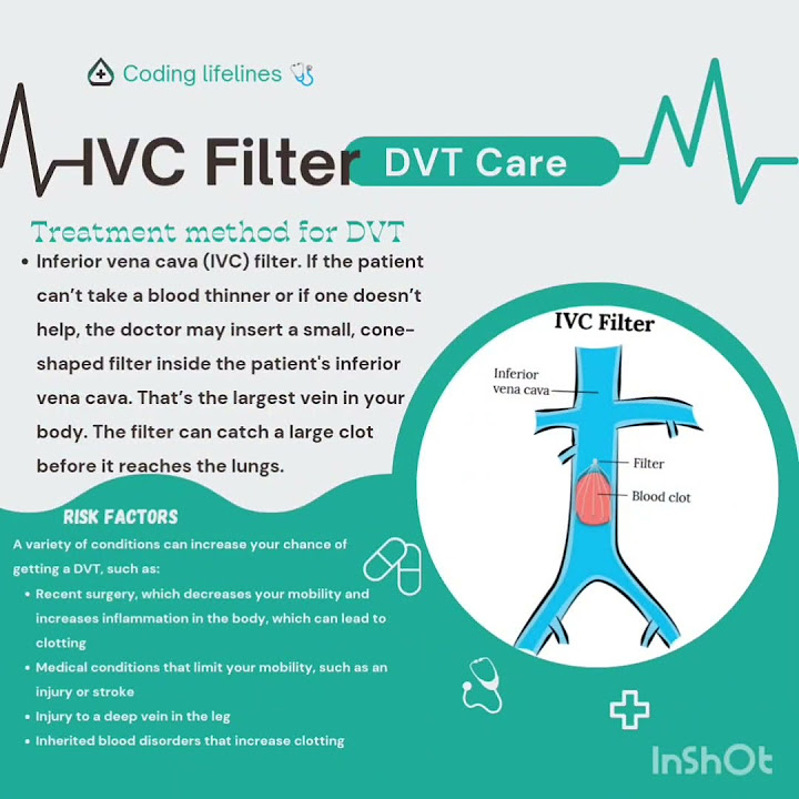 Dvt Ivc Filter Medicalcoding Anatomy Codingtips Youtube