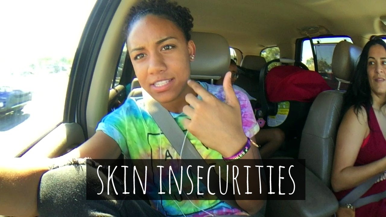 Feeling insecure about my skin - YouTube