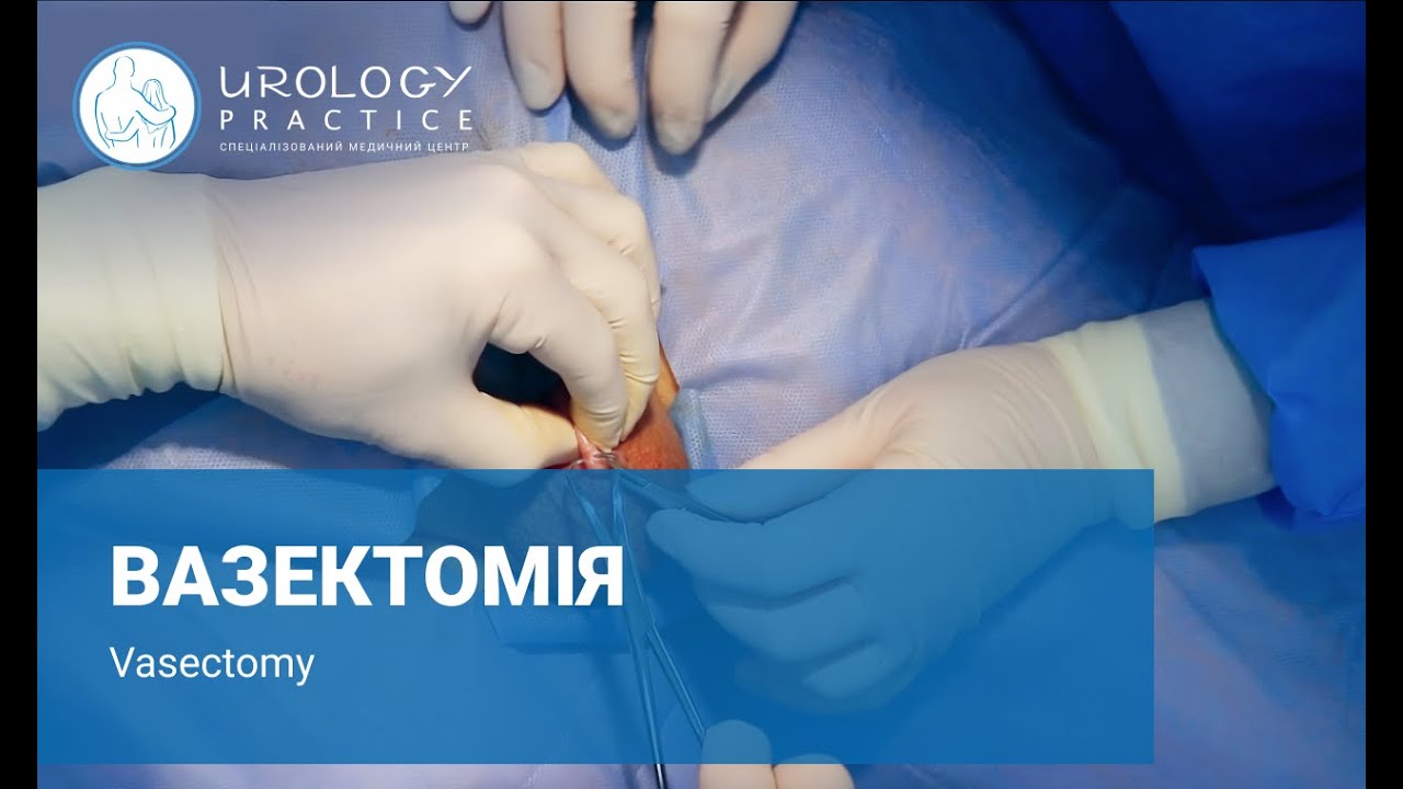 Вазектомія як 100% постійна контрацепція / Vasectomy as 100% permanent ...