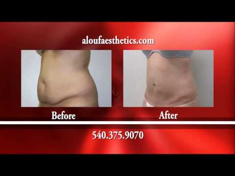 Tummy Tuck Commercial