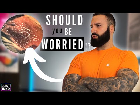 Dealing with PIMPLES, IRRITATION, RASHES & INFECTION on a NEW TATTOO