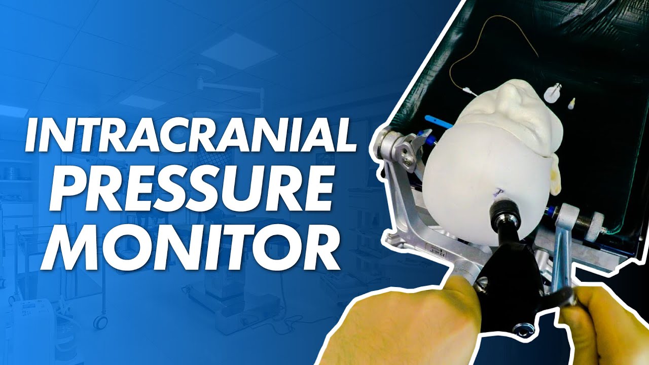 Intracranial Pressure Monitoring - What is it? - YouTube
