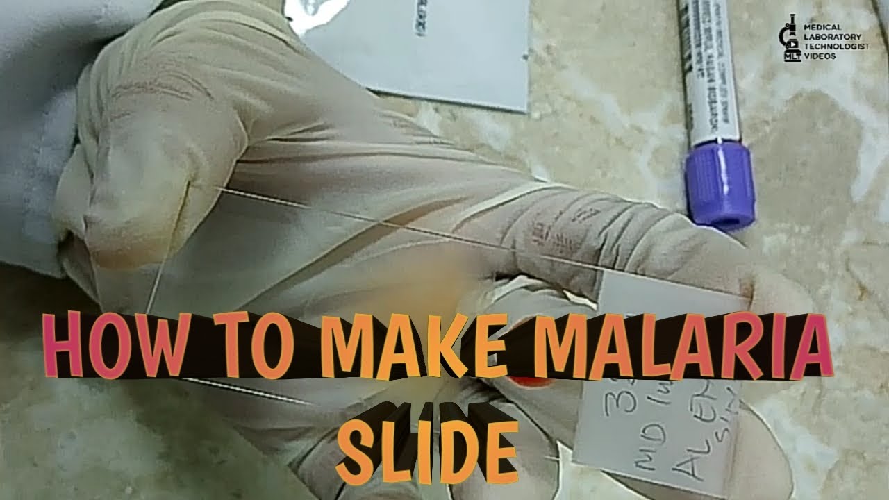 How to make malaria slides?2 ways to make malaria slides. - YouTube