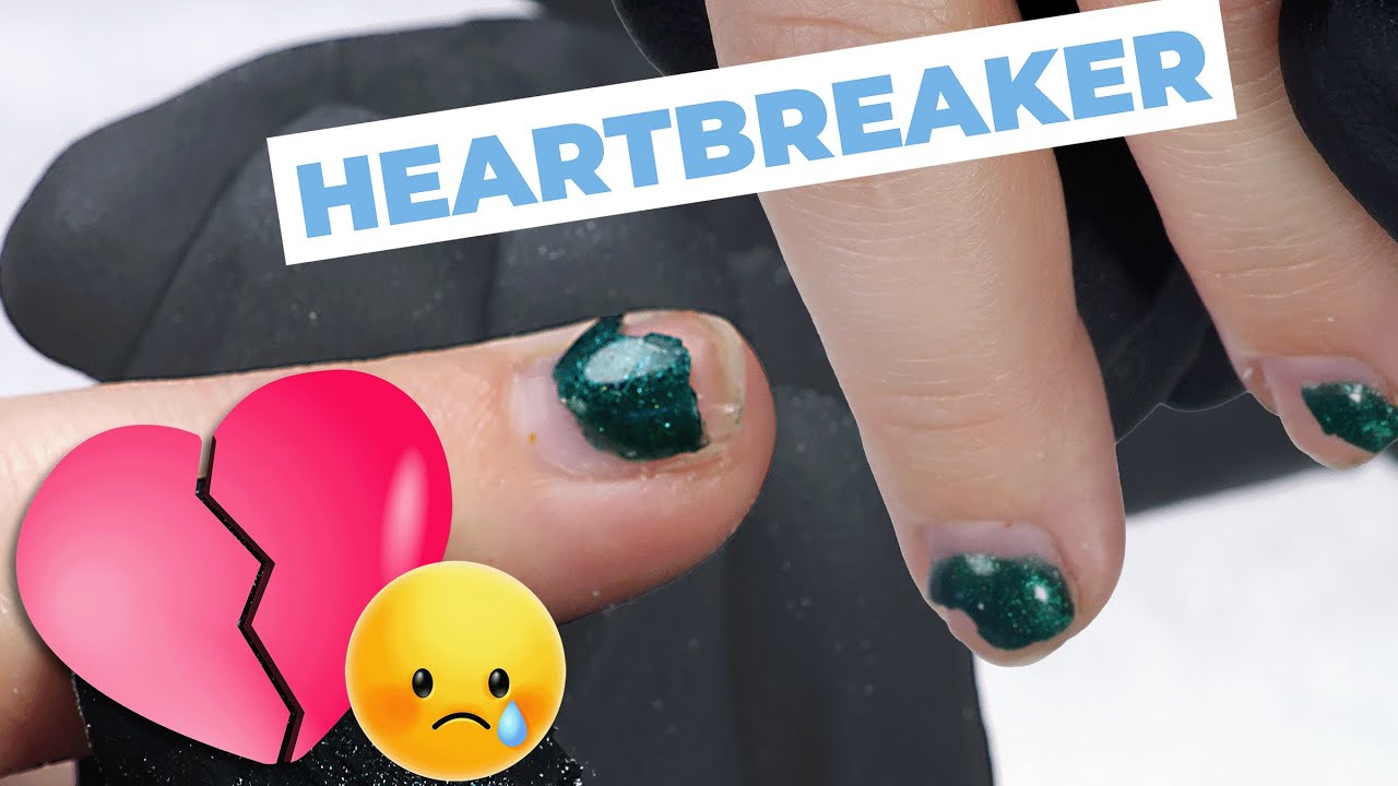 A Journey to Healthy Nails - Safe Nail Efiling - YouTube