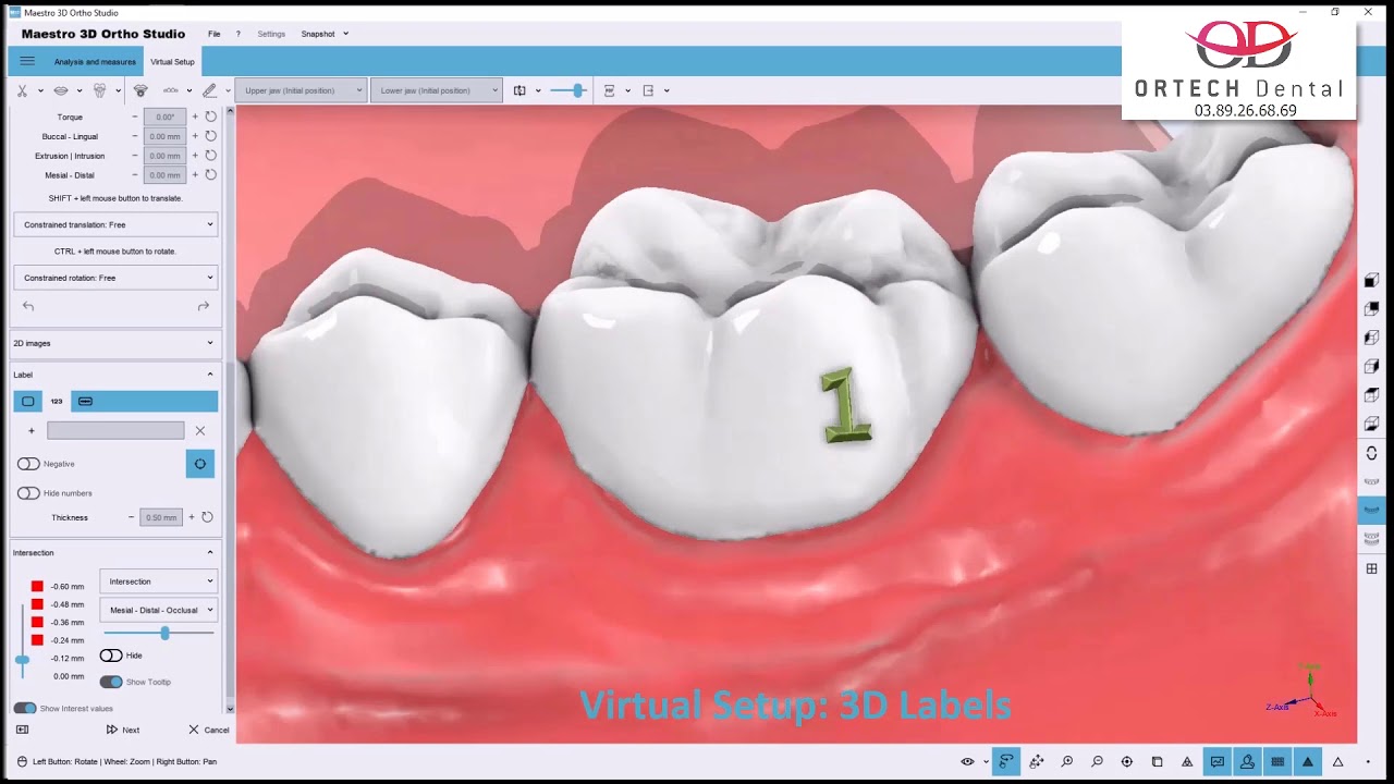 Ortho Studio 2019 - YouTube