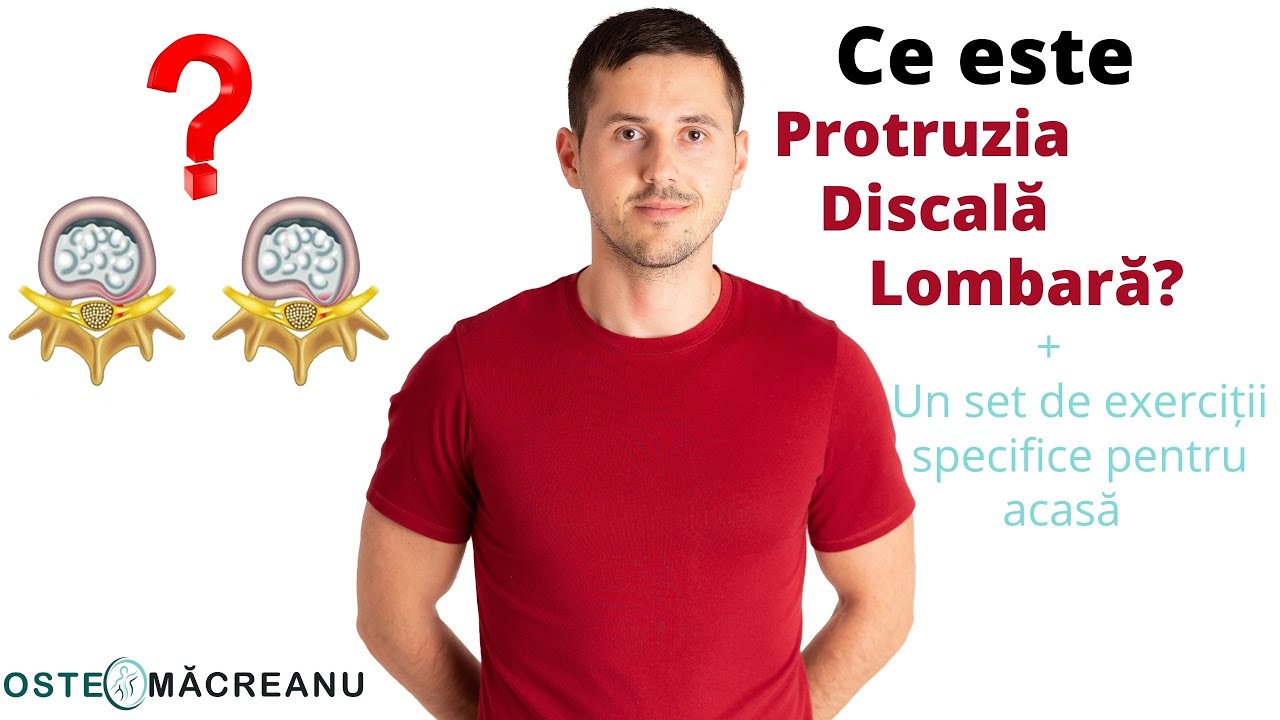 Ce este Protruzia Discală Lombară? - YouTube