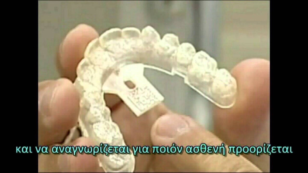 The invisalign manufacturing process (with Greek translation) - YouTube