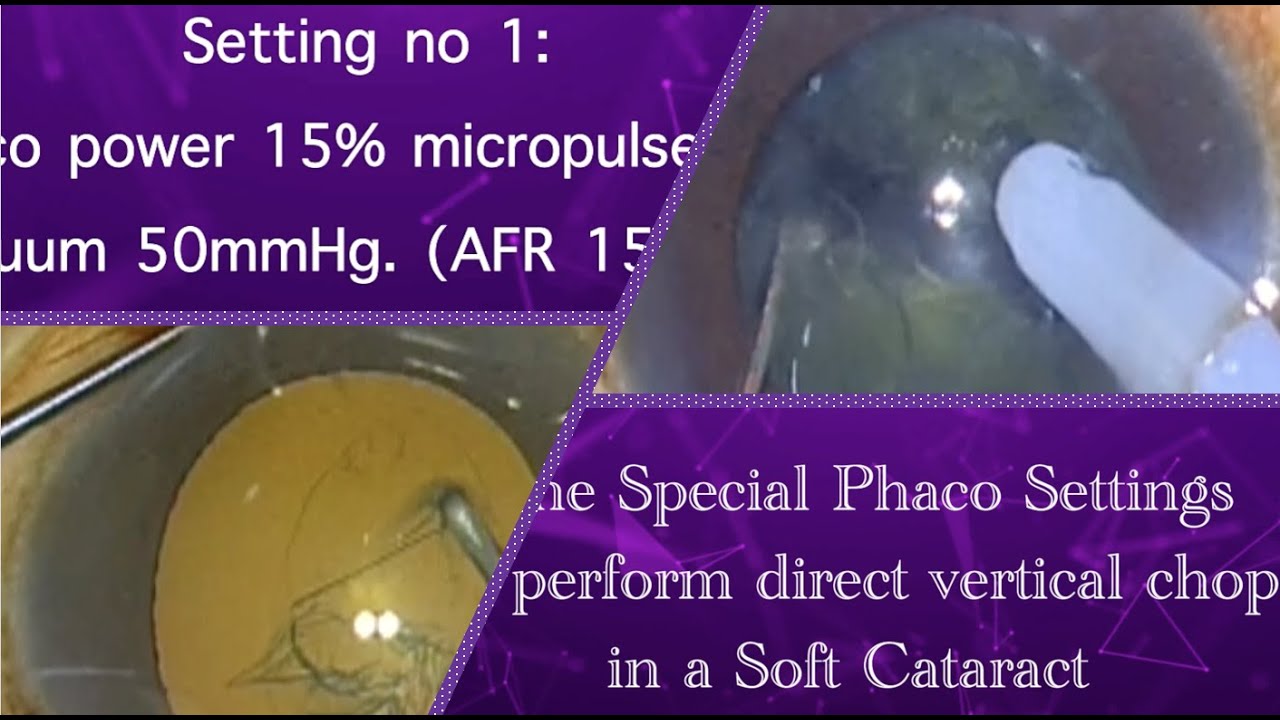 Special Settings that will help you to perform direct vertical chop in ...