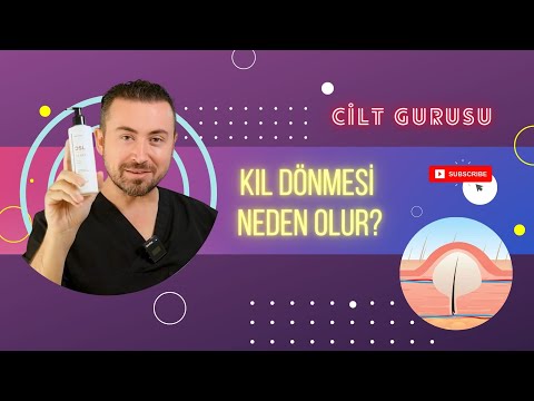 Kıl Dönmesi Neden Olur? Nasıl Tedavi Edilir?