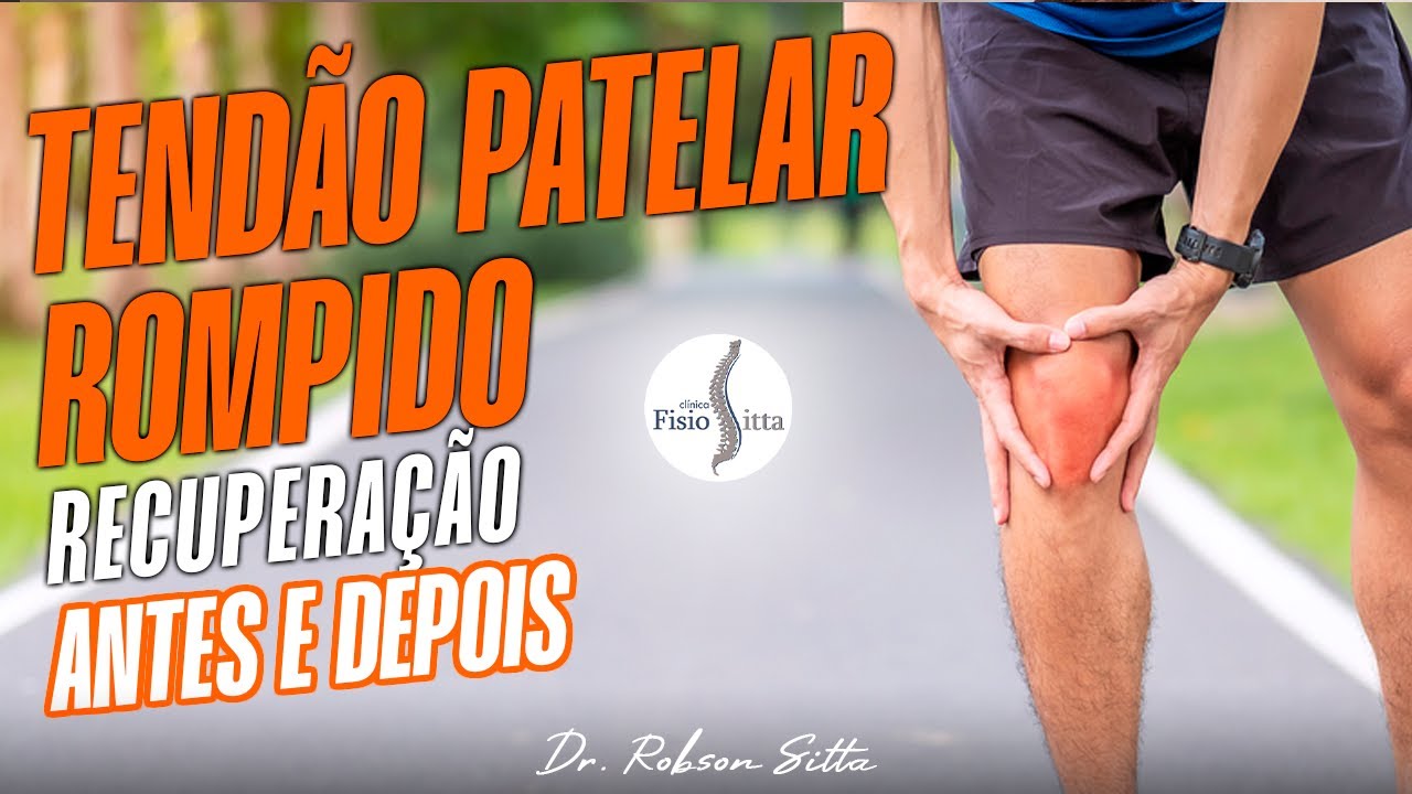 RUPTURA do TENDÃO PATELAR do JOELHO FISIOTERAPIA RECUPERAÇÃO da ...