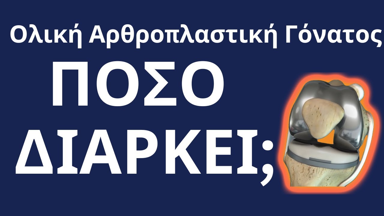 Πόσο διαρκεί μια Ολική Αρθροπλαστική Γόνατος; #orthopaidikos - YouTube