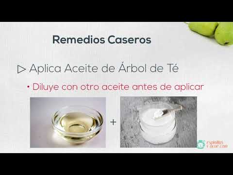 Espinillas Enterradas 👨‍⚕️ Remedios Caseros Para Quitarlas Rápido!