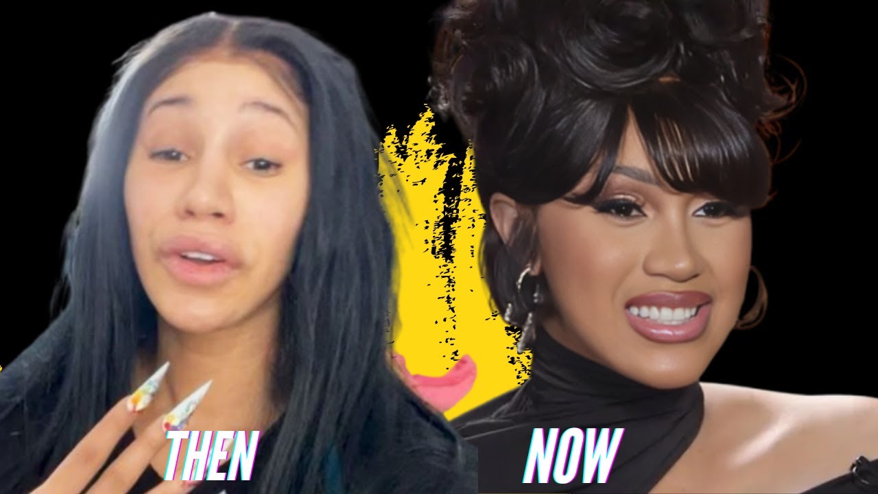 RAPPERS WHO HAVE DONE PLASTIC SURGERY | THE NEW ERA OF PLASTIC ...