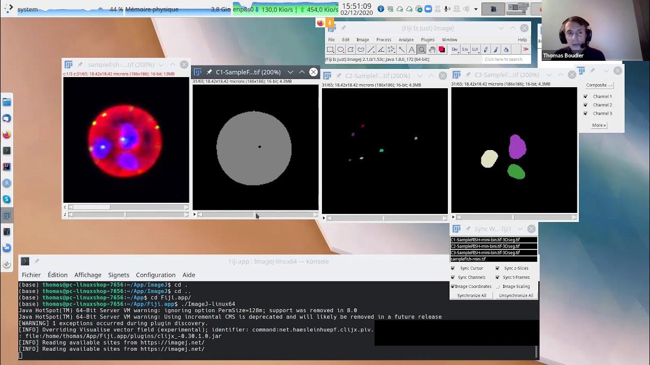 I2K 2020 tutorial: 3D Analysis with the 3D ImageJ Suite (session 2 ...