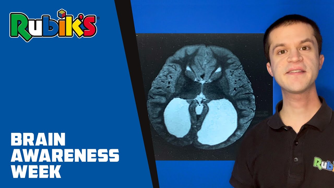 AC Cuber Sam Richard | Brain Awareness Week #SamsSolutions - YouTube