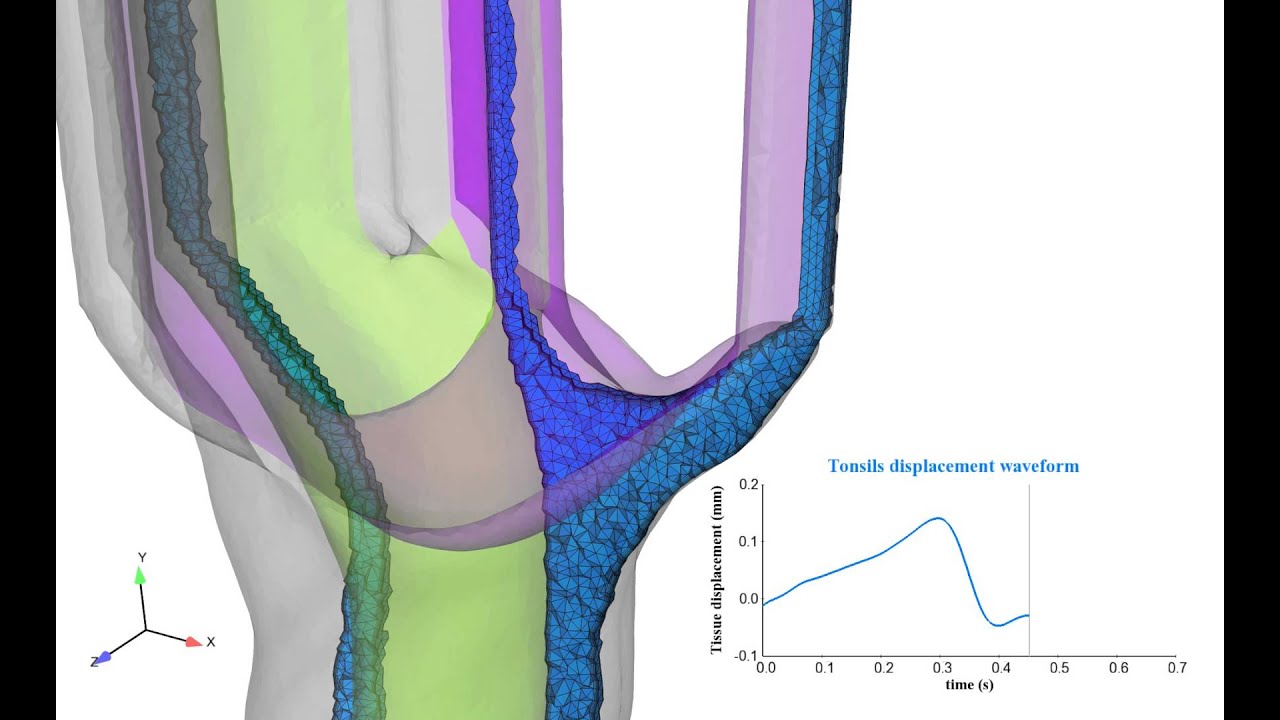 Adaptive grid for moving boundary CFD simulation of CSF flow - YouTube