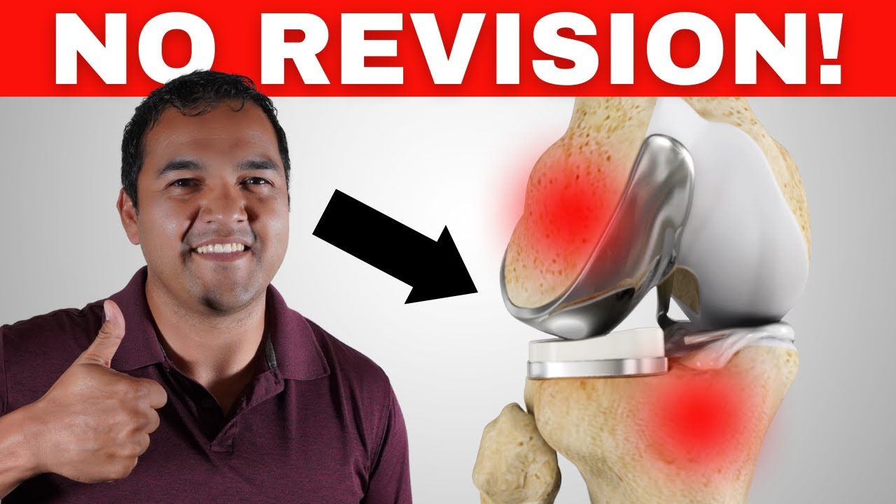 How To Get A Knee Replacement Without Insurance at Arthur Dwyer blog How To Get A Knee Replacement Without Insurance at Arthur Dwyer blog