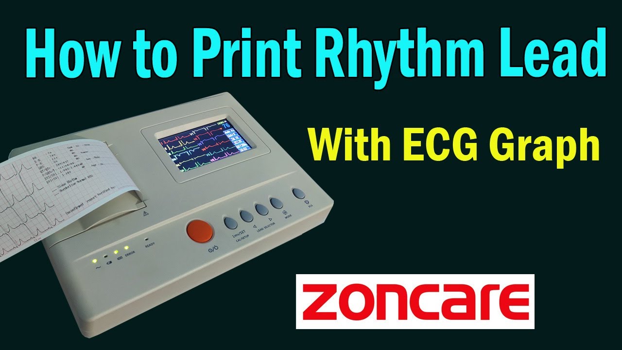 How to print ECG graph with Rhythm Lead. Zoncare ZQ-1203G. Time Medical ...