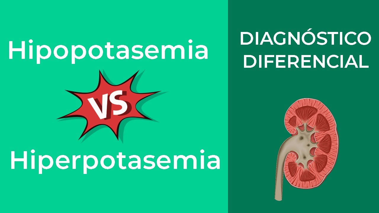 Hipopotassemia O Que é - RETOEDU