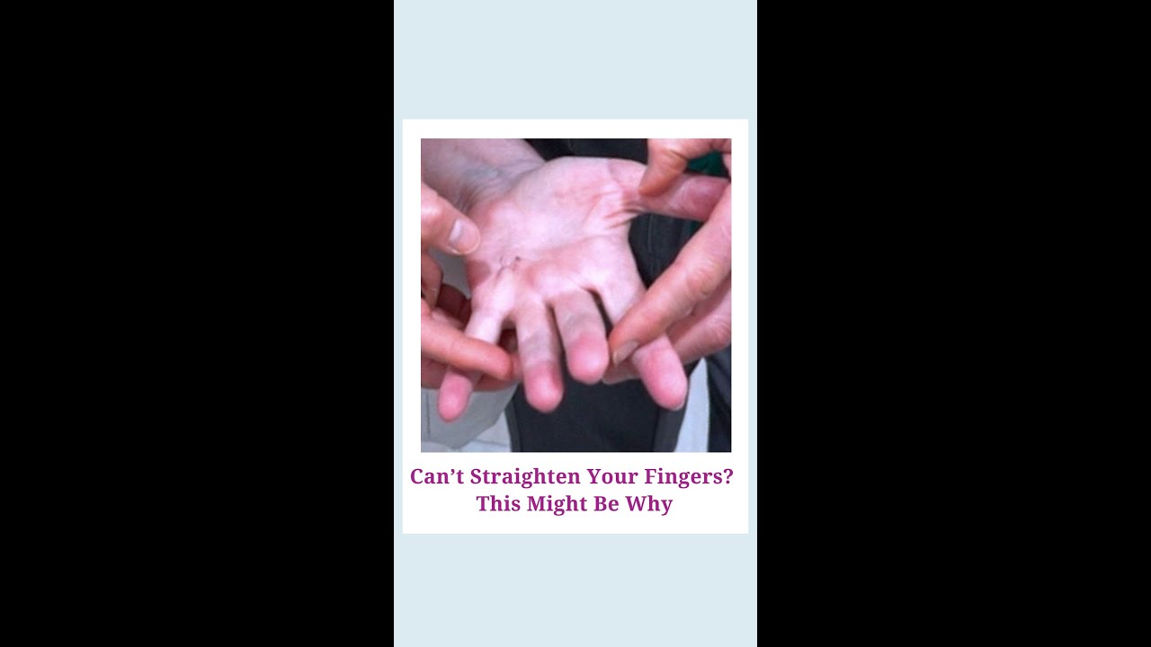 Can’t Straighten Your Fingers? This Might Be Why - YouTube