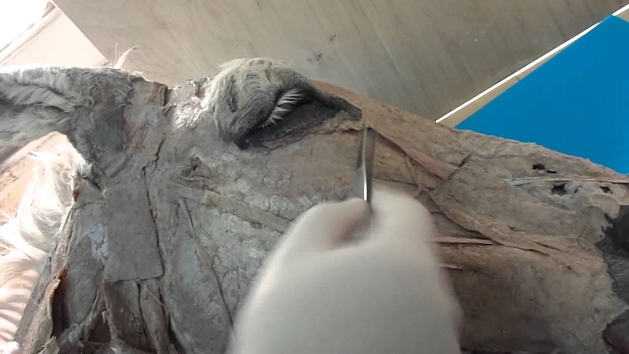 superficial dissection of face - YouTube