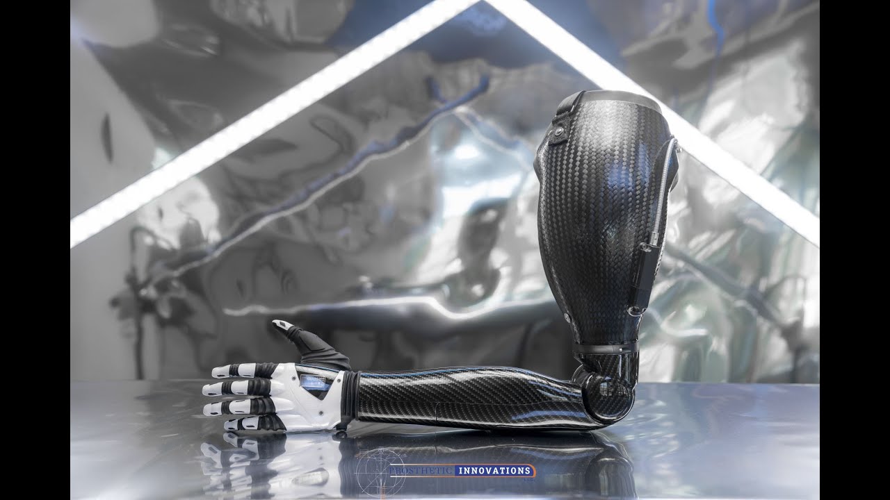 Trans-Humeral Myo-Electric Prosthesis | Prosthetic Innovations - YouTube