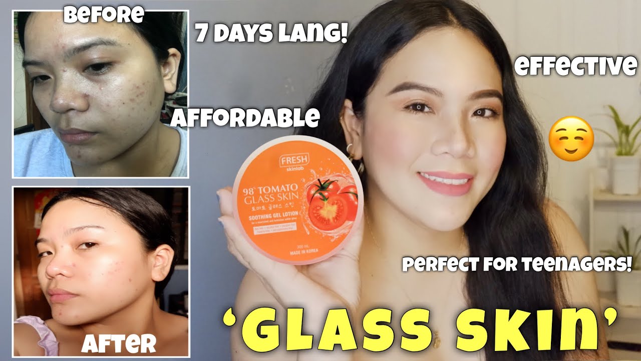 HOW I CLEARED MY PIMPLE MARKS, DARK SPOTS IN JUST 7 DAYS | TOMATO GLASS ...