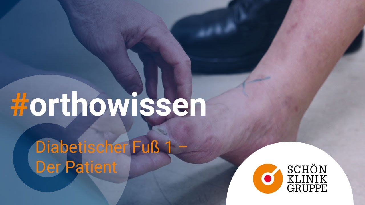 Wissensforum Orthopädie: Diabetischer Fuß - Der Patient (Teil 1) - YouTube