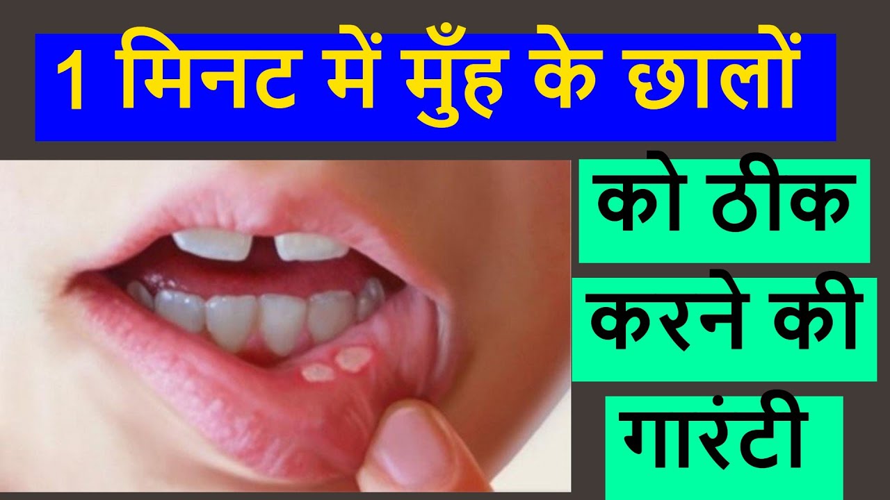 Muh Ke Chale Kaise Thik Kare YouTube muh-ke-chale-kaise-thik-kare-youtube