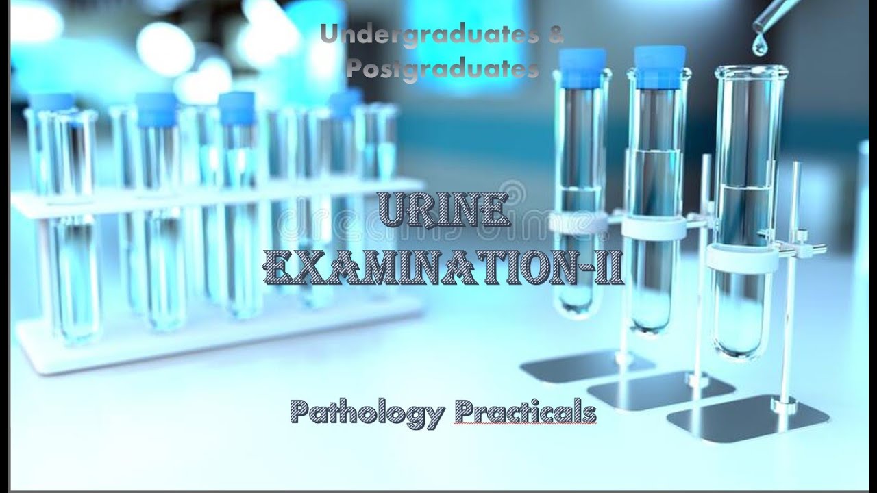 PG and UG Practical -URINE ANALYSIS - II | |RATS [GAME] |DR GSS ...