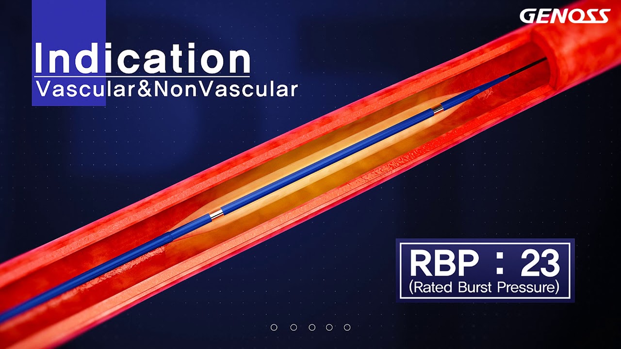 Genoss PTA Balloon Catheter - YouTube