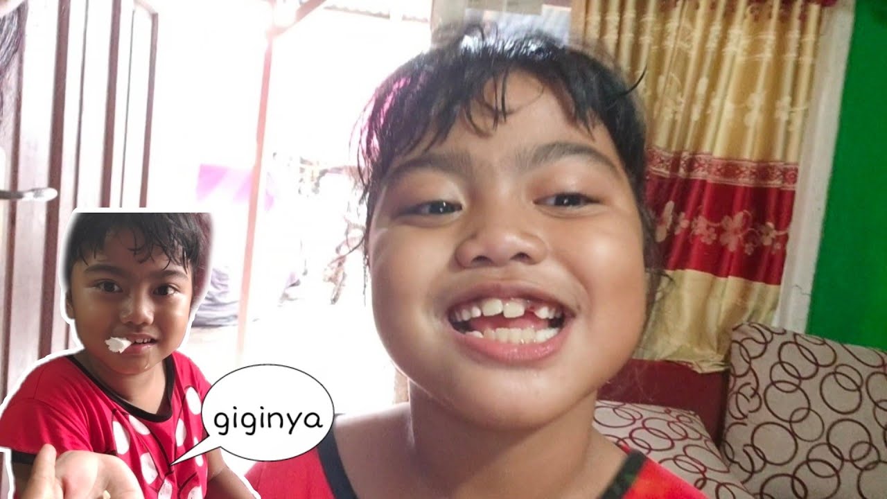 Ayla Berani Cabut Gigi Sendiri - YouTube