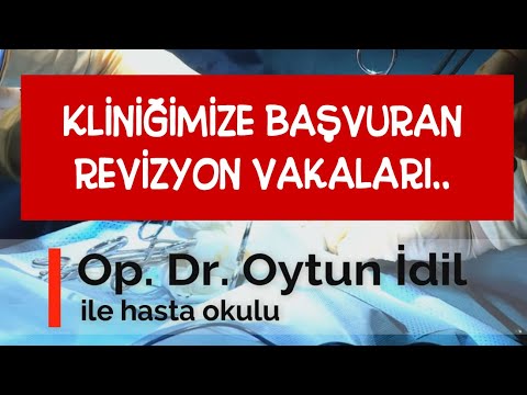 Bize başvuran (penis büyütme) revizyon vakaları..