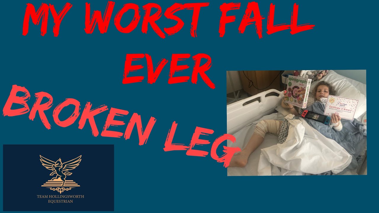 WORST FALL EVER !!!! BROKEN LEG - YouTube