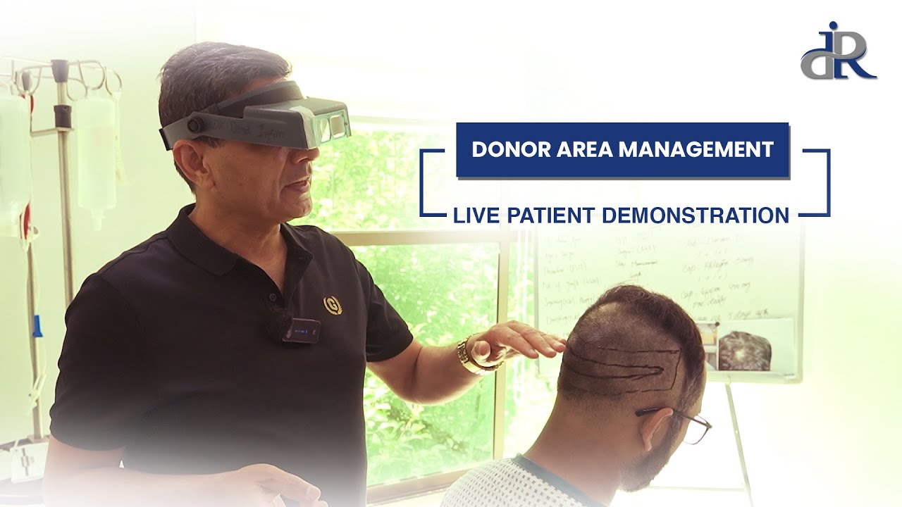 Donor Area Management Guide | Understanding Process of Donor Area ...