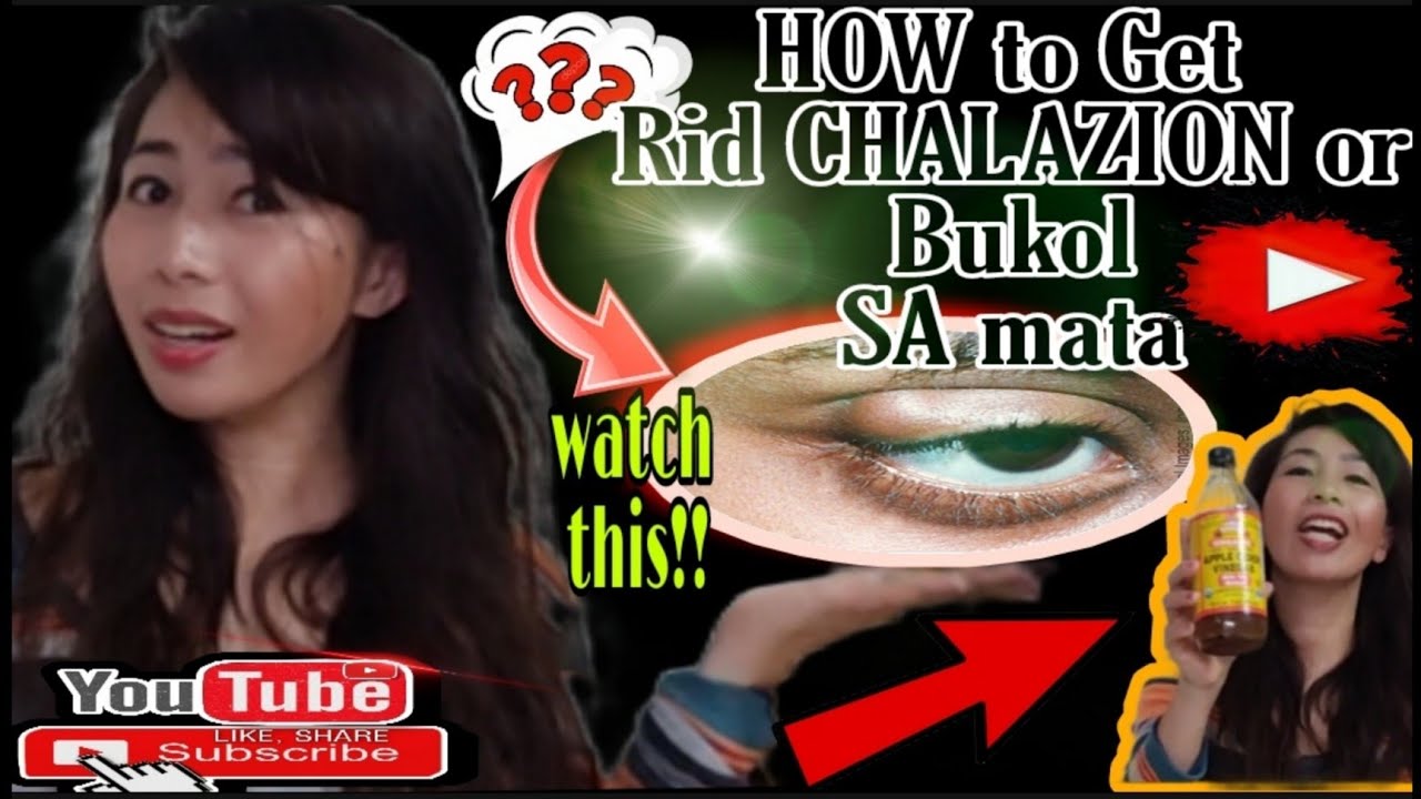 HOME REMEDIES FOR CHALAZION OR BUKOL SA MATA||EASY AND EFFECTIVE - YouTube