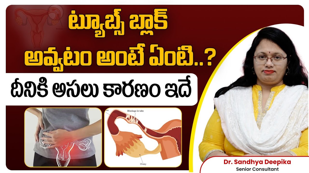 Fallopian Tube Blockage: Causes and Treatment Options | What Causes ...
