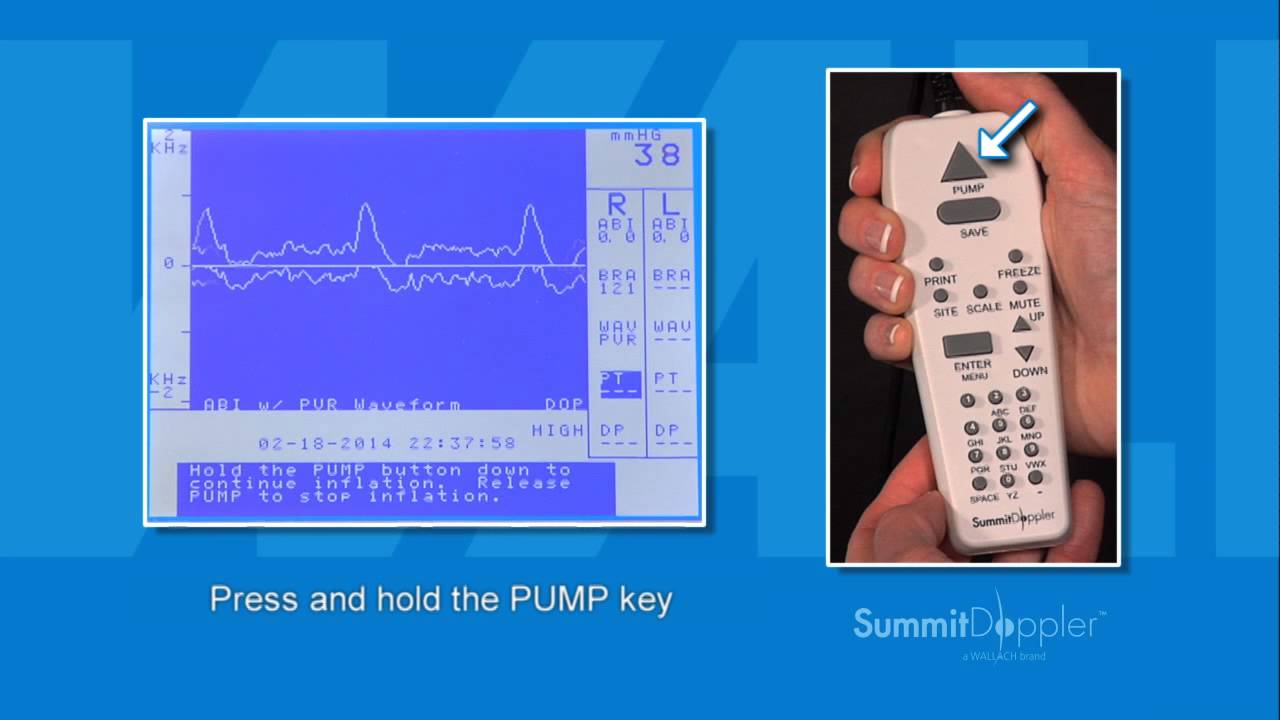 Single Level ABI with PVR Waveform - YouTube