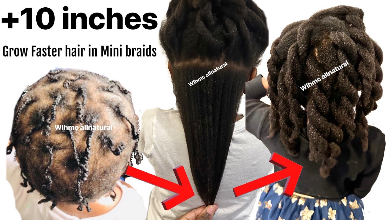 Fastest Way to Grow hair in Mini Braids! Get +10 Inches fast in Jesus ...