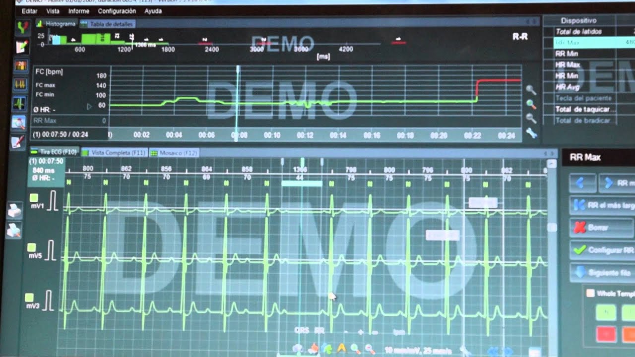 CardioPoint holter 300 BTL - YouTube