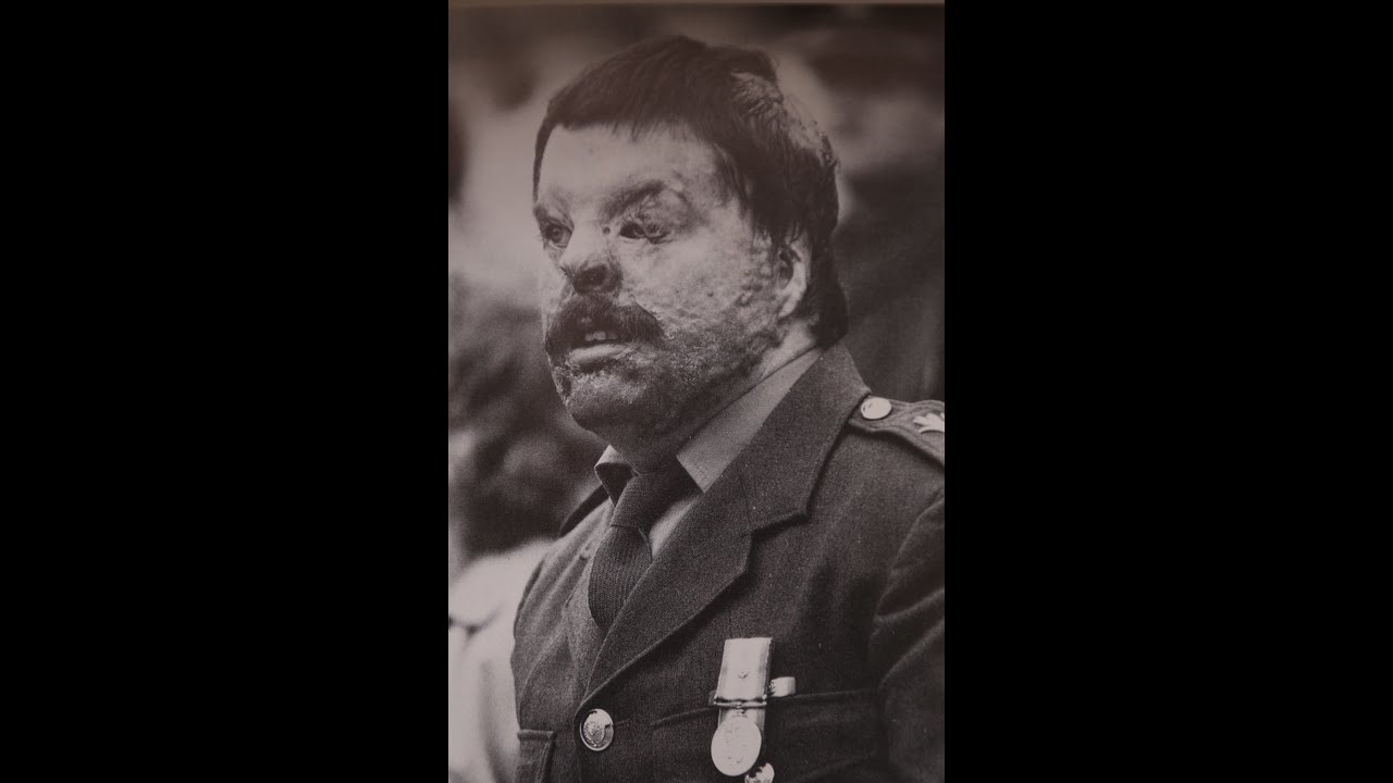 Falklands hero Simon Weston: "I was the closest to the bomb to survive ...