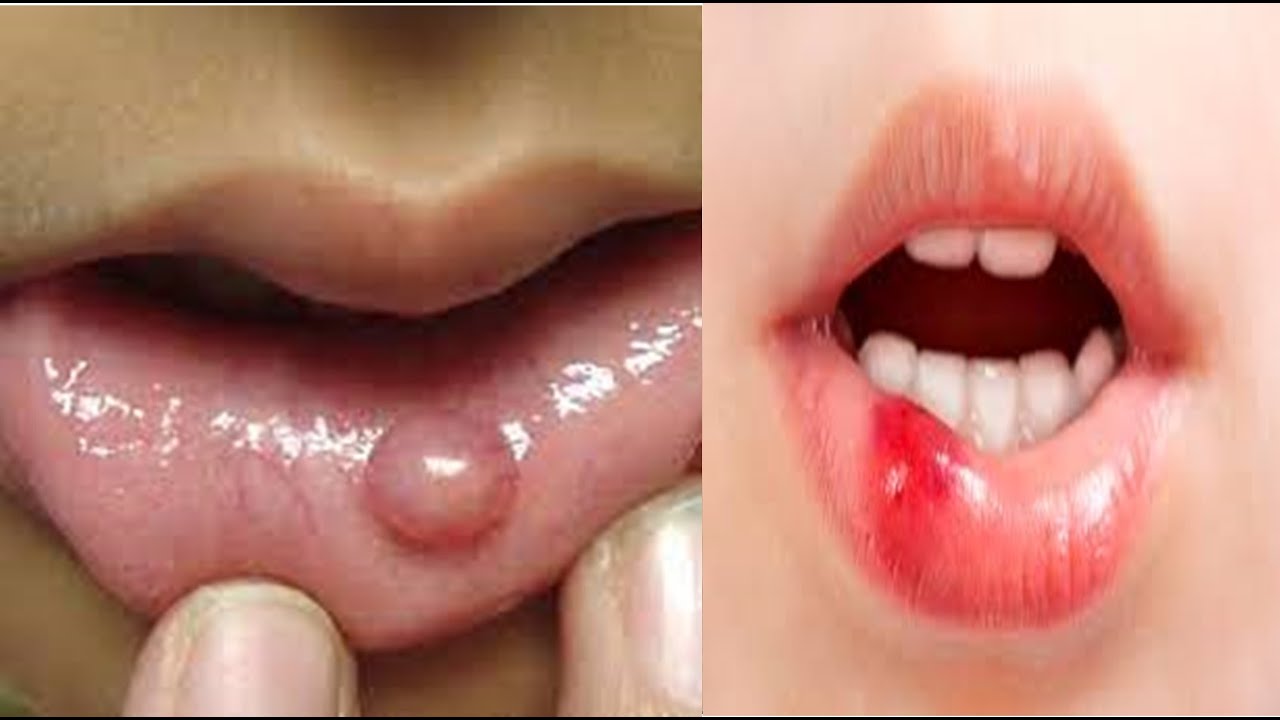 Caroco No Ceu Da Boca - BRUNIV