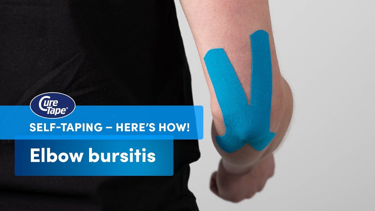 How to Tape for Elbow Bursitis | Pain Relief and Support | Kinesiology ...