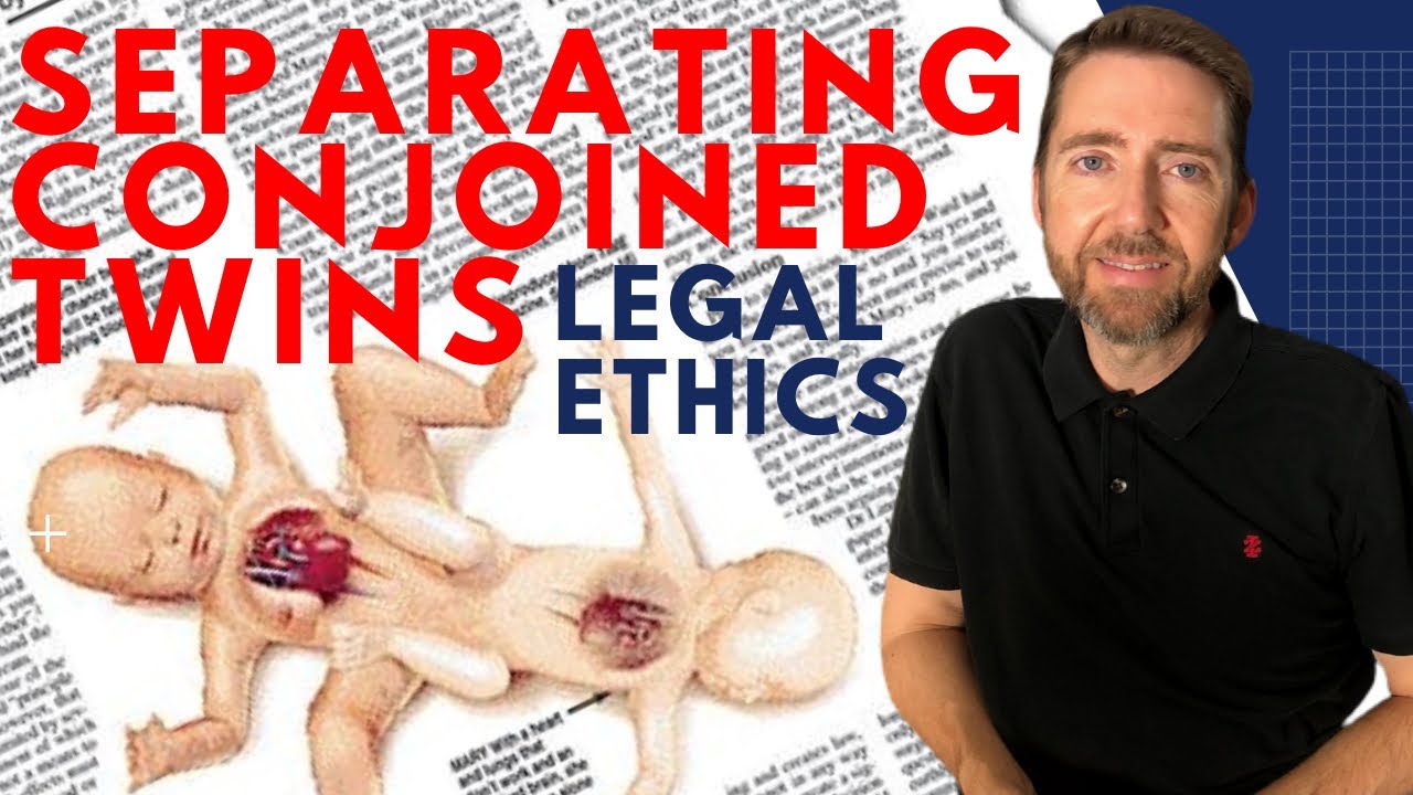 The Legal Ethics of Separating Conjoined Twins - YouTube