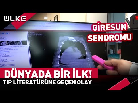 🔴Dünyada İlk! Giresun'da Tıp Literatürüne Geçen Olay #haber